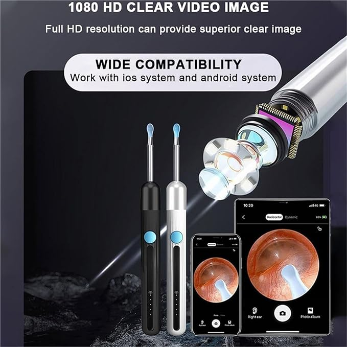 Slivor VisioEar: Safe and Easy Ear Cleaning at Home